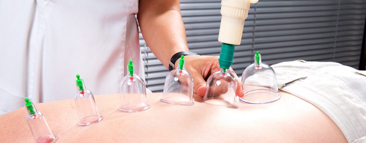 Myofascial Active Cupping Technique For Pain Relief > Degree Qualified